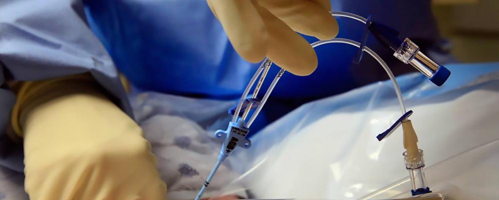 Infermieri. La gestione degli AVC nel paziente oncologico. Pubblicate ...