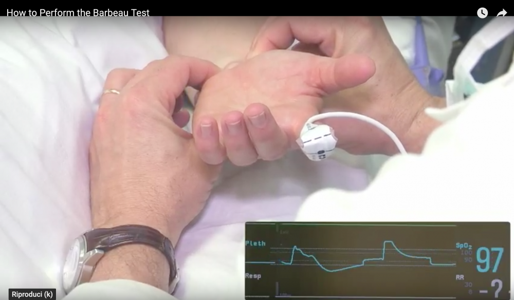 Il Reverse Barbeau Test per valutare occlusione arteria. Come si esegue ...